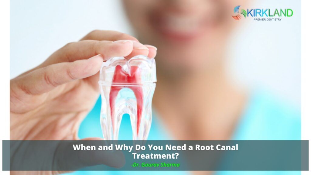 When-and-Why-Do-You-Need-a-Root-Canal-Treatment_-1024x576.jpg